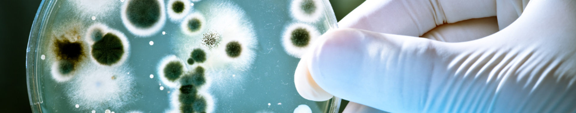 Colony Forming Units - CFU in water bearing systems