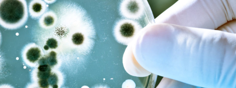 Colony Forming Units - CFU in water bearing systems